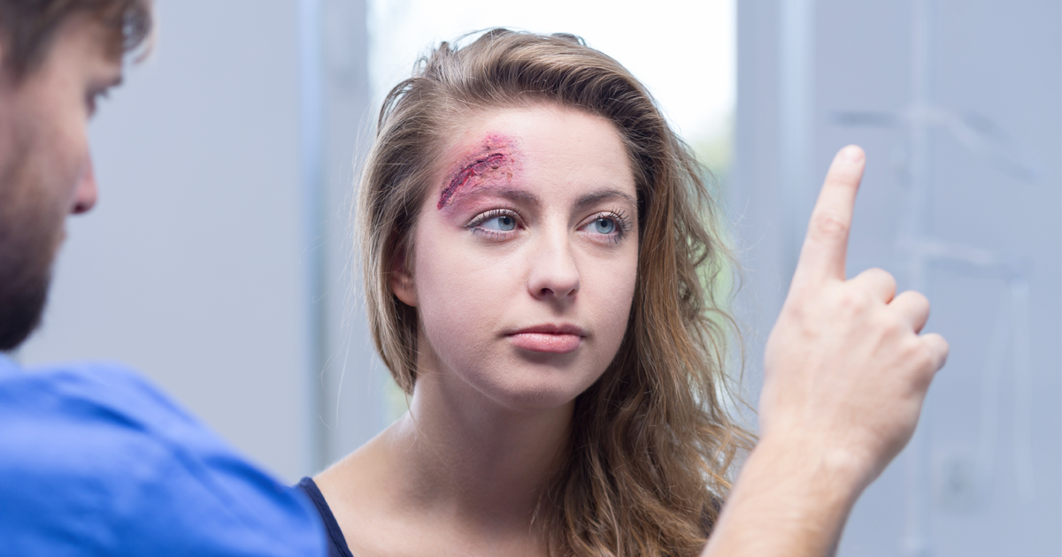 What Women Need to Know About Concussions - Girls Gone Strong